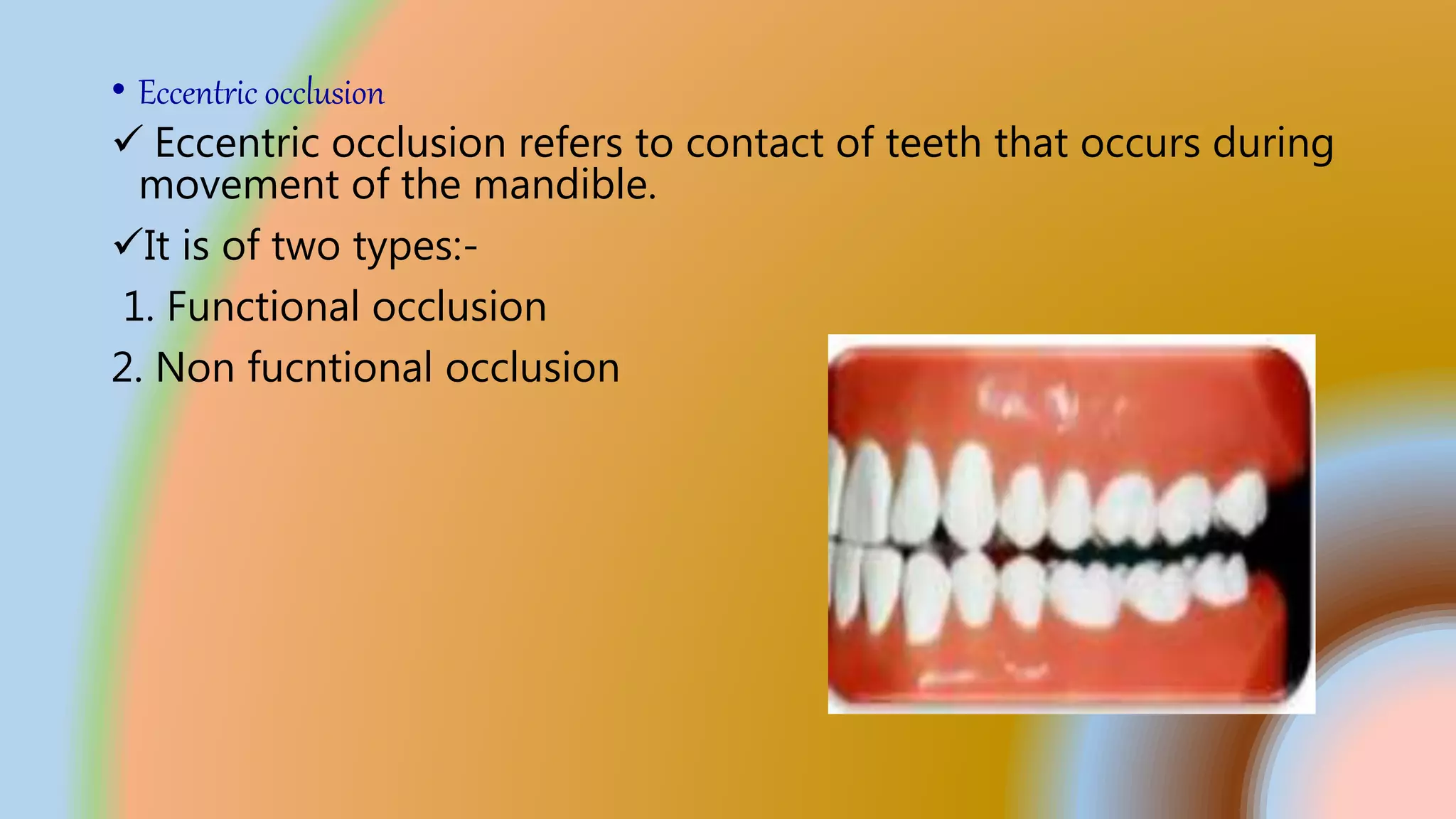 Balanced occlusion | PPTX