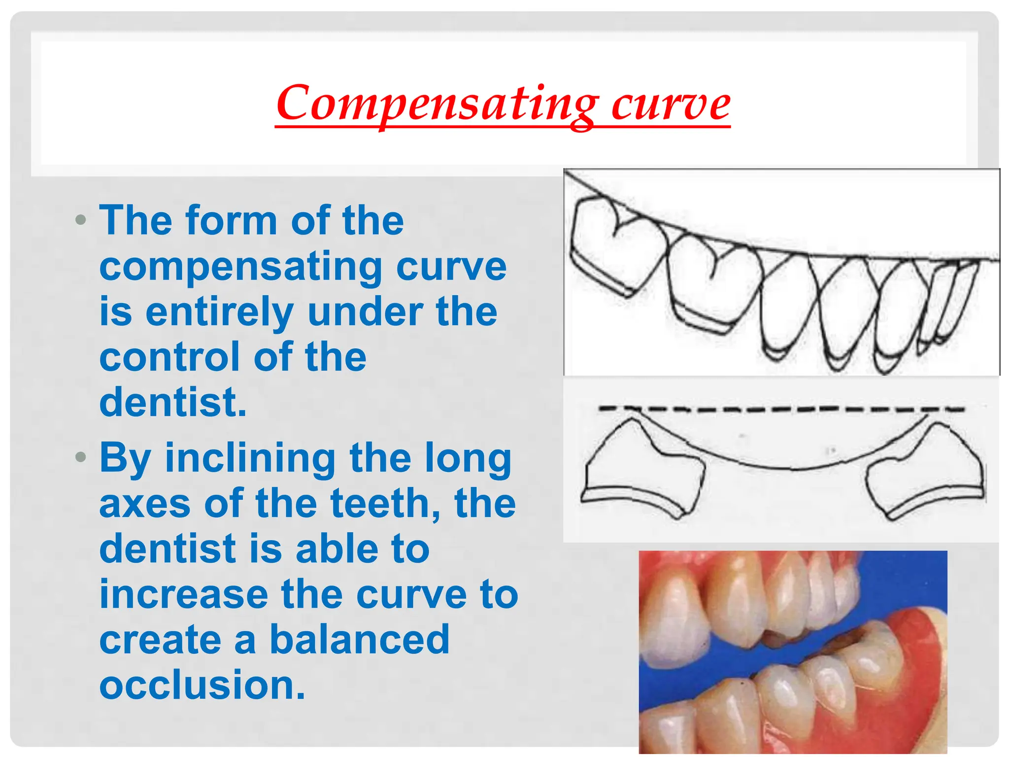 BALANCED OCCLUSION.pptx