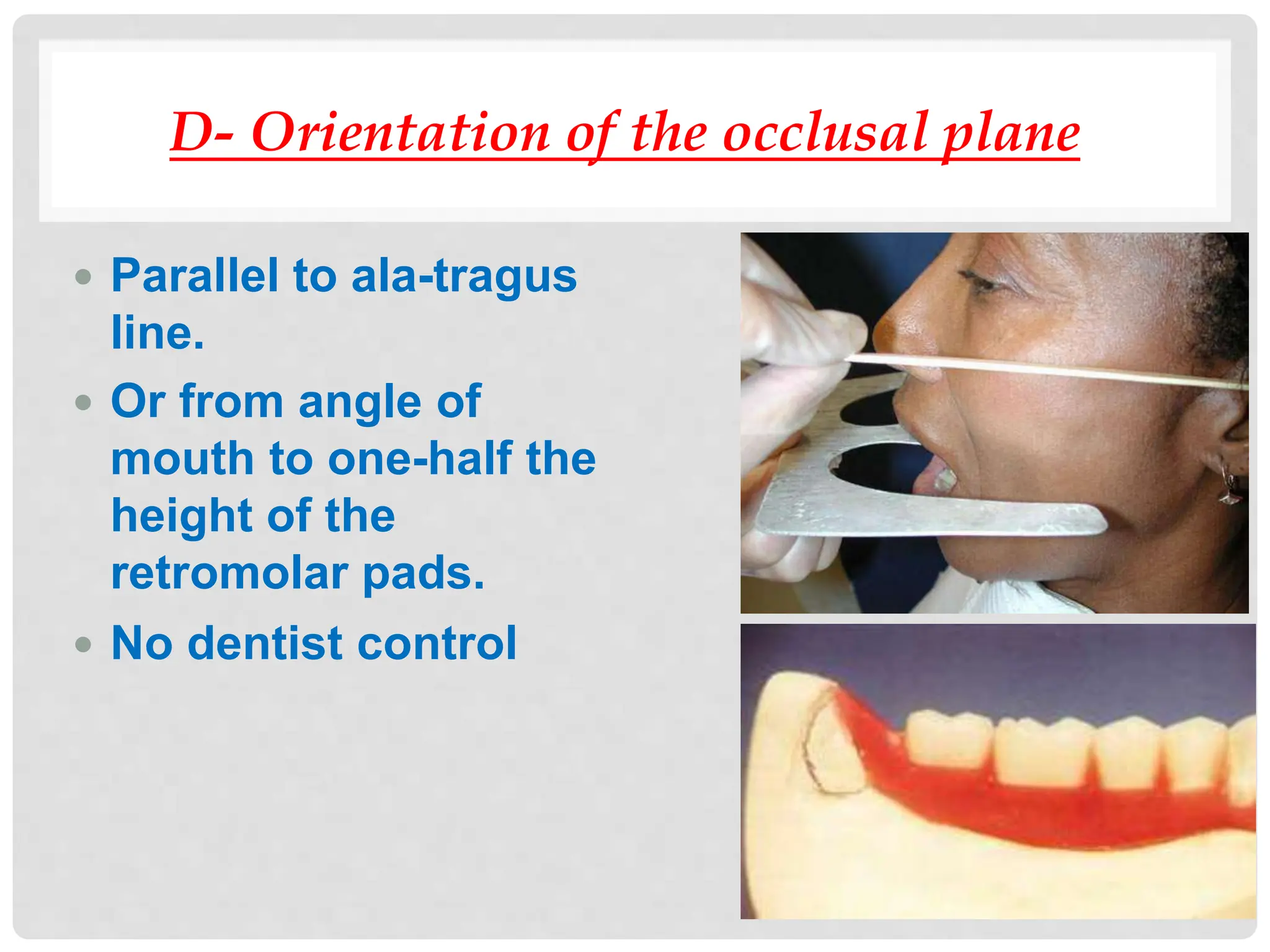 BALANCED OCCLUSION.pptx