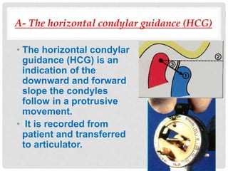 BALANCED OCCLUSION.pptx