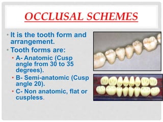 BALANCED OCCLUSION.pptx