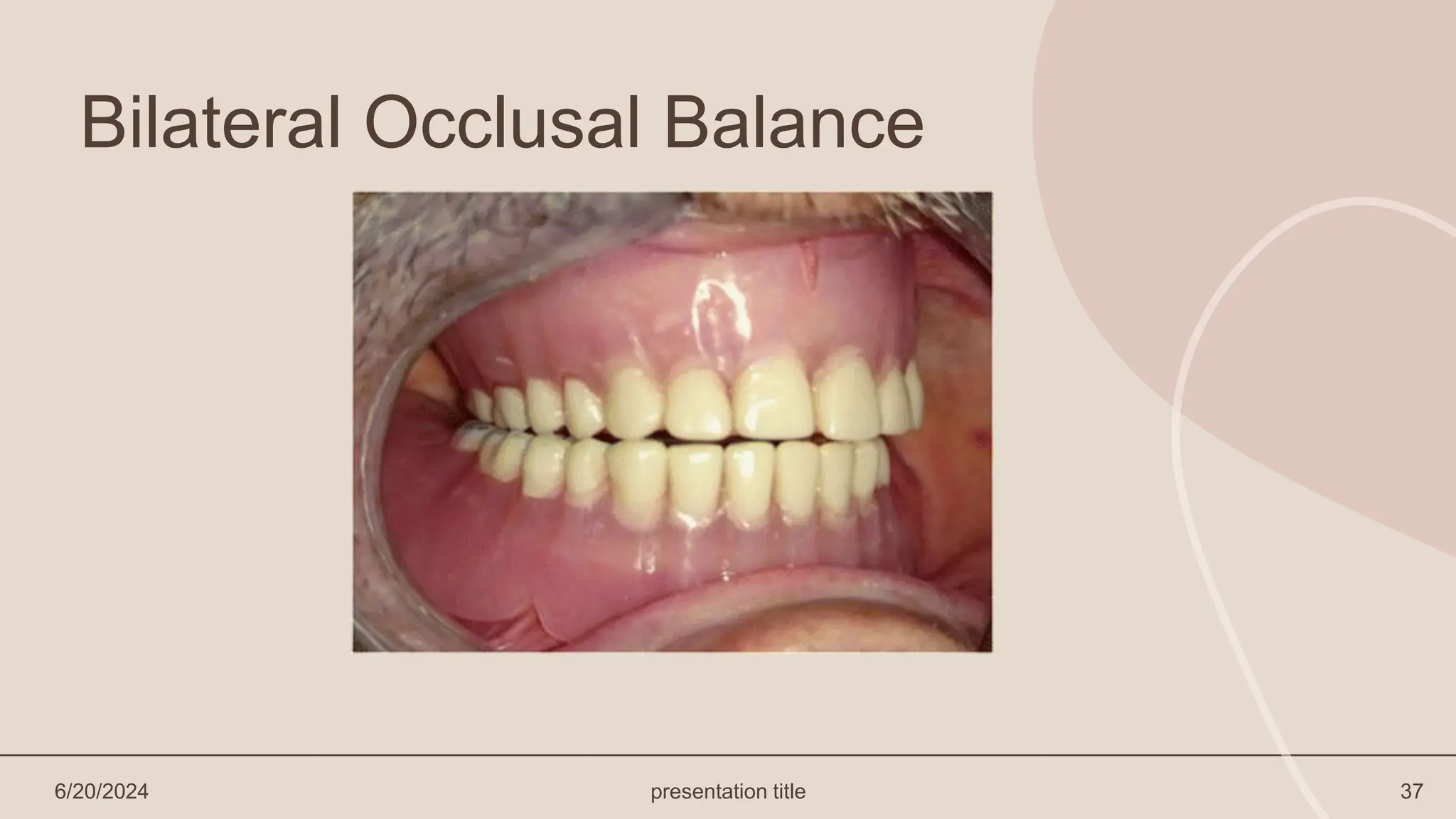 BALANCED OCCLUSION. pptx | PPTX