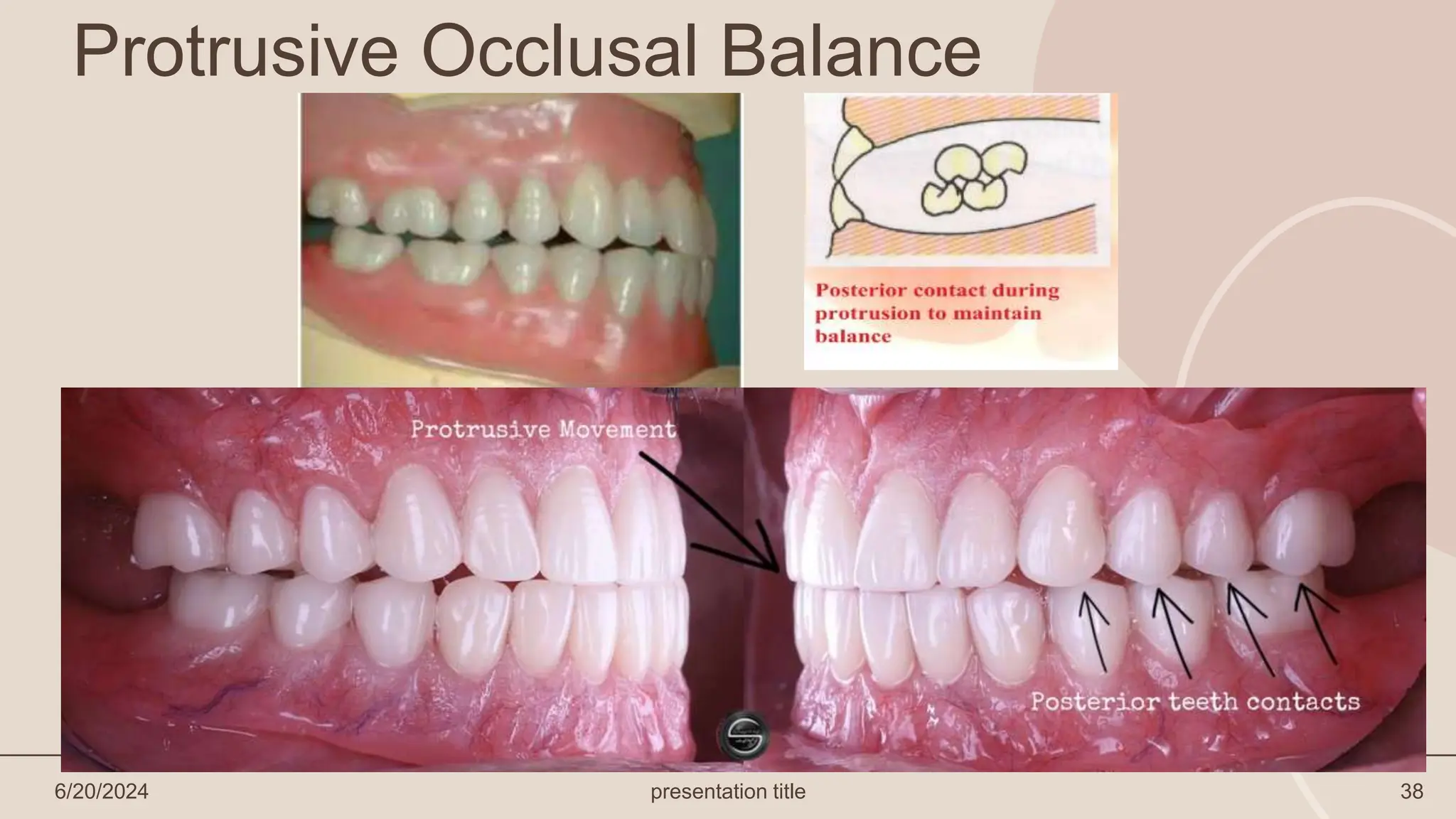 BALANCED OCCLUSION. pptx | PPTX