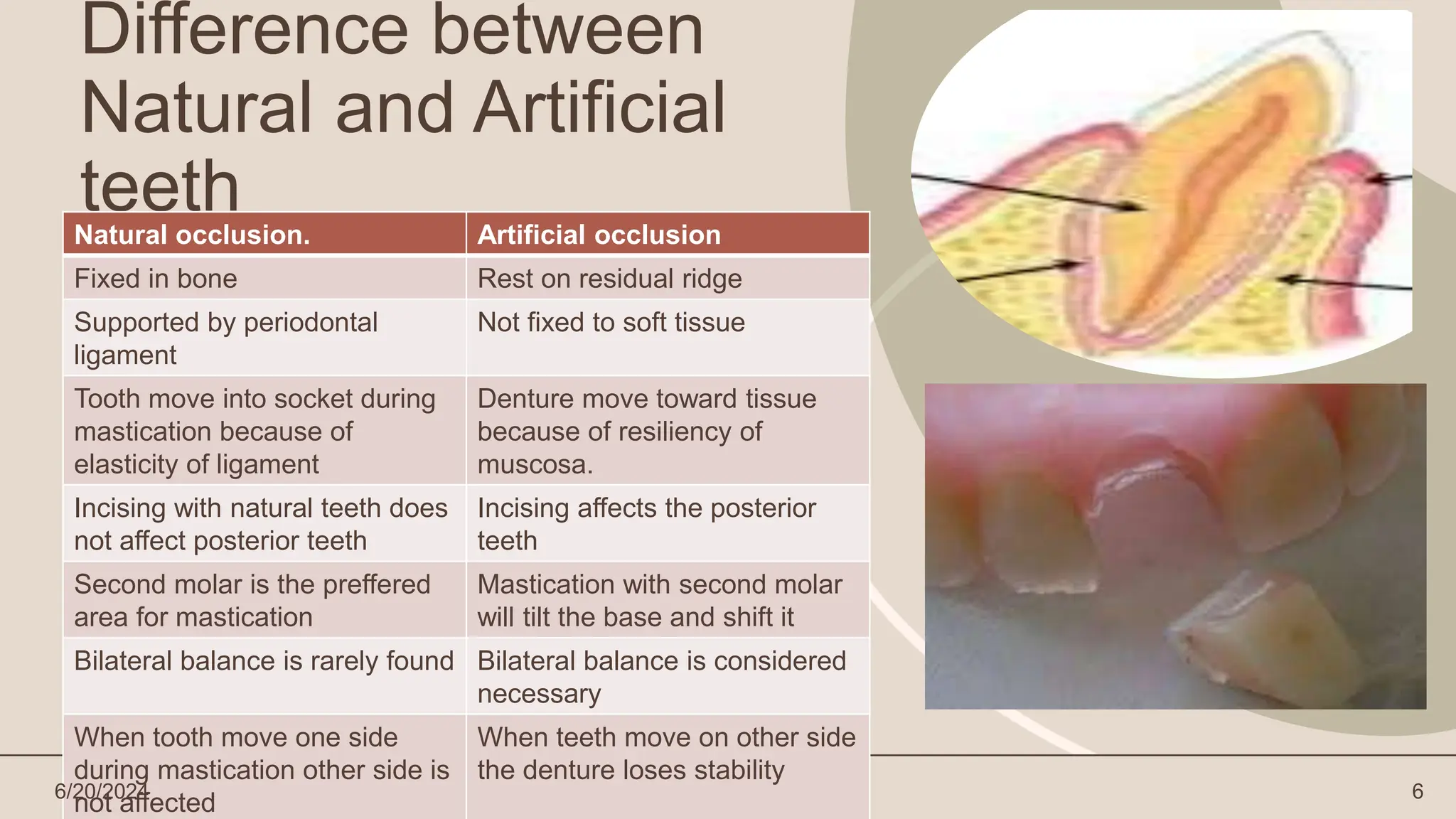 BALANCED OCCLUSION. pptx | PPTX