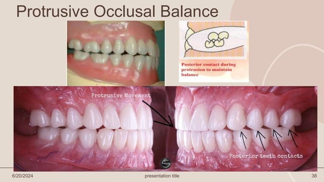 BALANCED OCCLUSION. pptx | PPTX