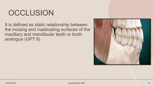 BALANCED OCCLUSION. pptx | PPTX
