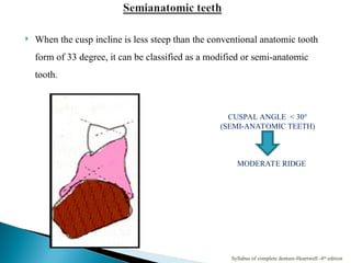 balancedocclusion in prosthodontics dentistry | PPT