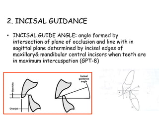 Balanced occlusion aditi ghai | PPTX