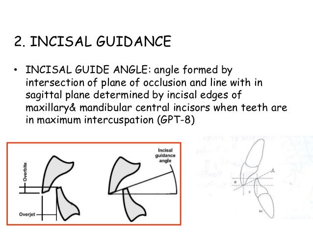 Balanced occlusion aditi ghai