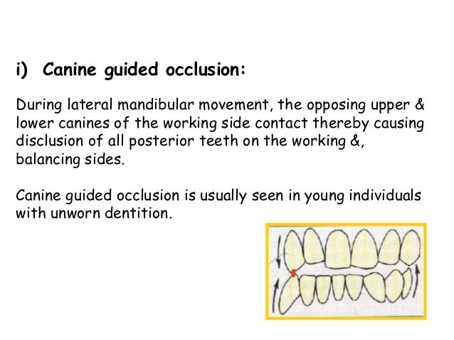 Canine Occlusion Classification