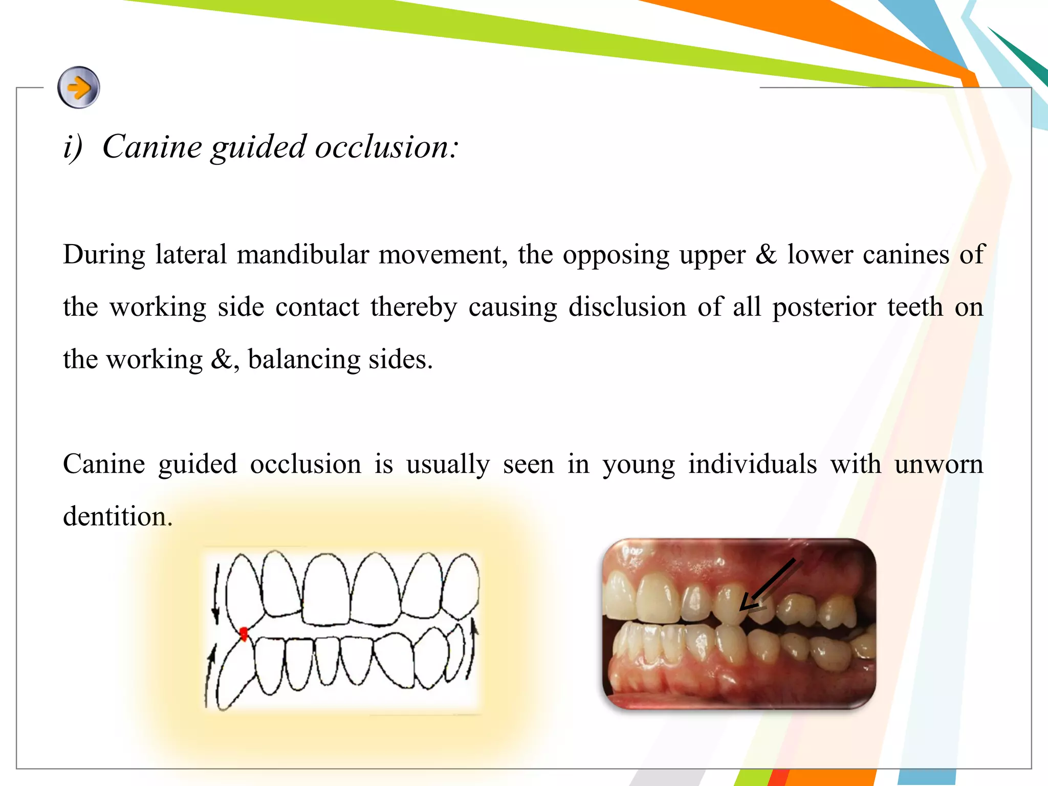 Balanced occlusion and its importance | PPT
