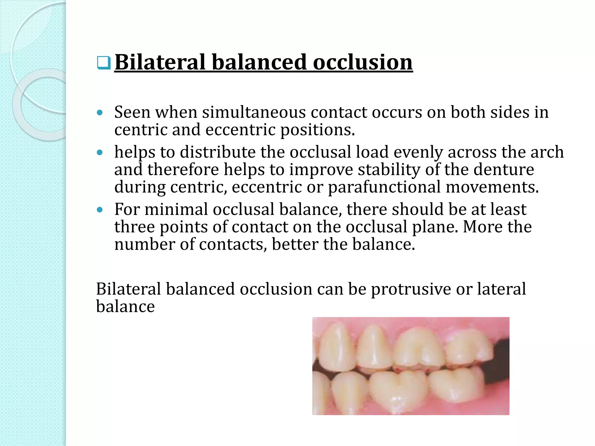 Balanced occlusion-different concepts | PPTX