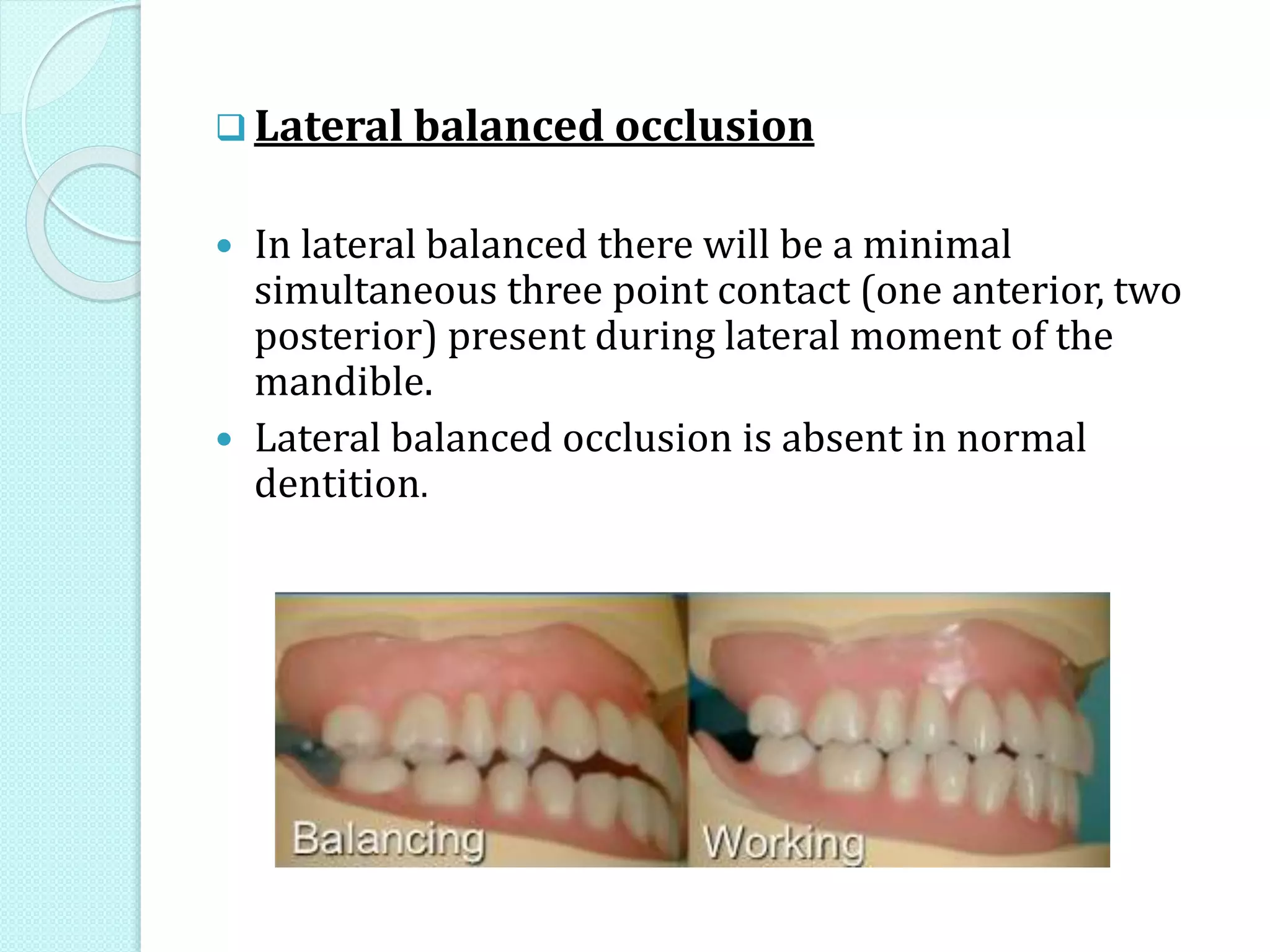 Balanced occlusion-different concepts | PPTX