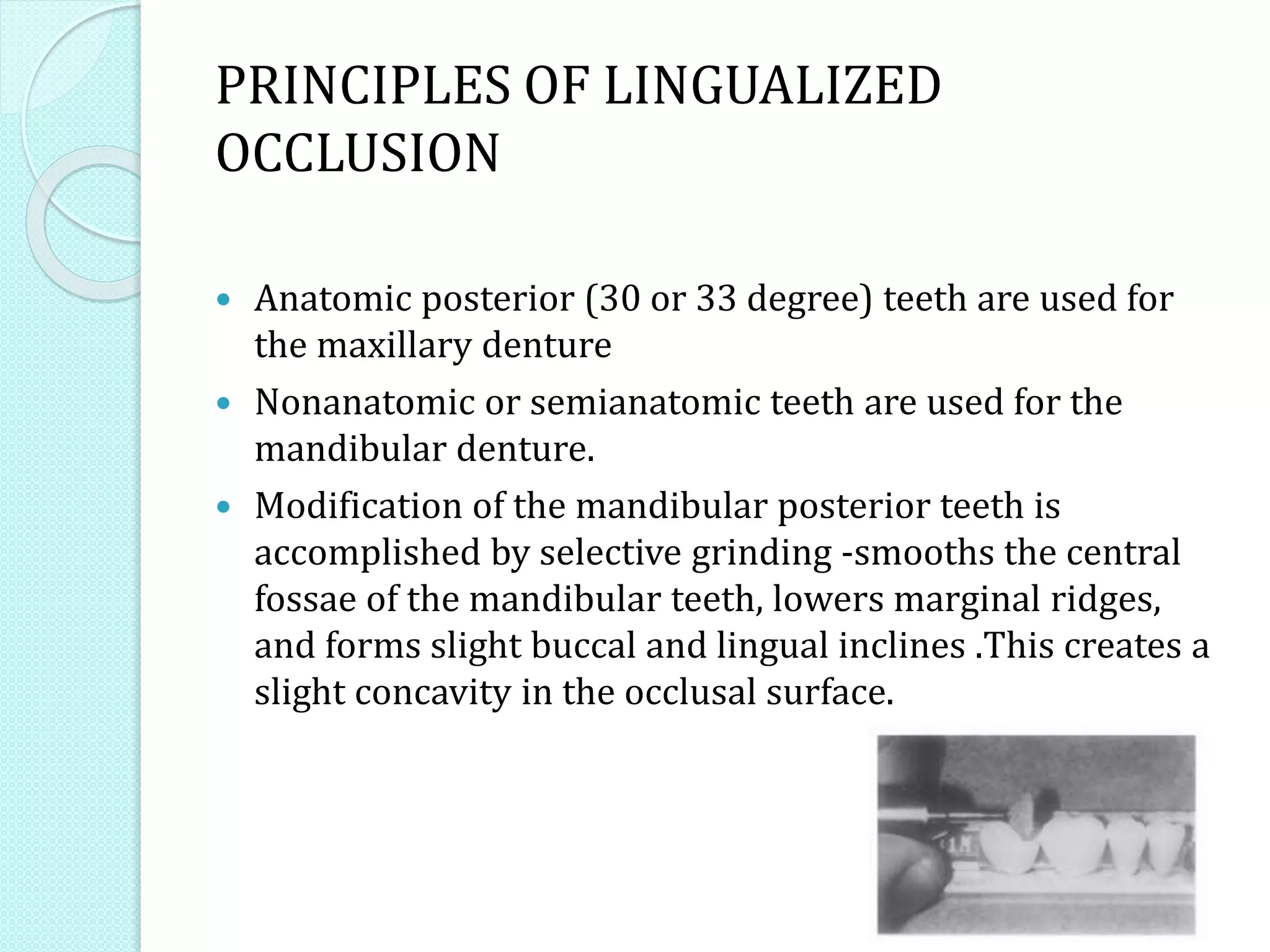 Balanced occlusion-different concepts | PPTX