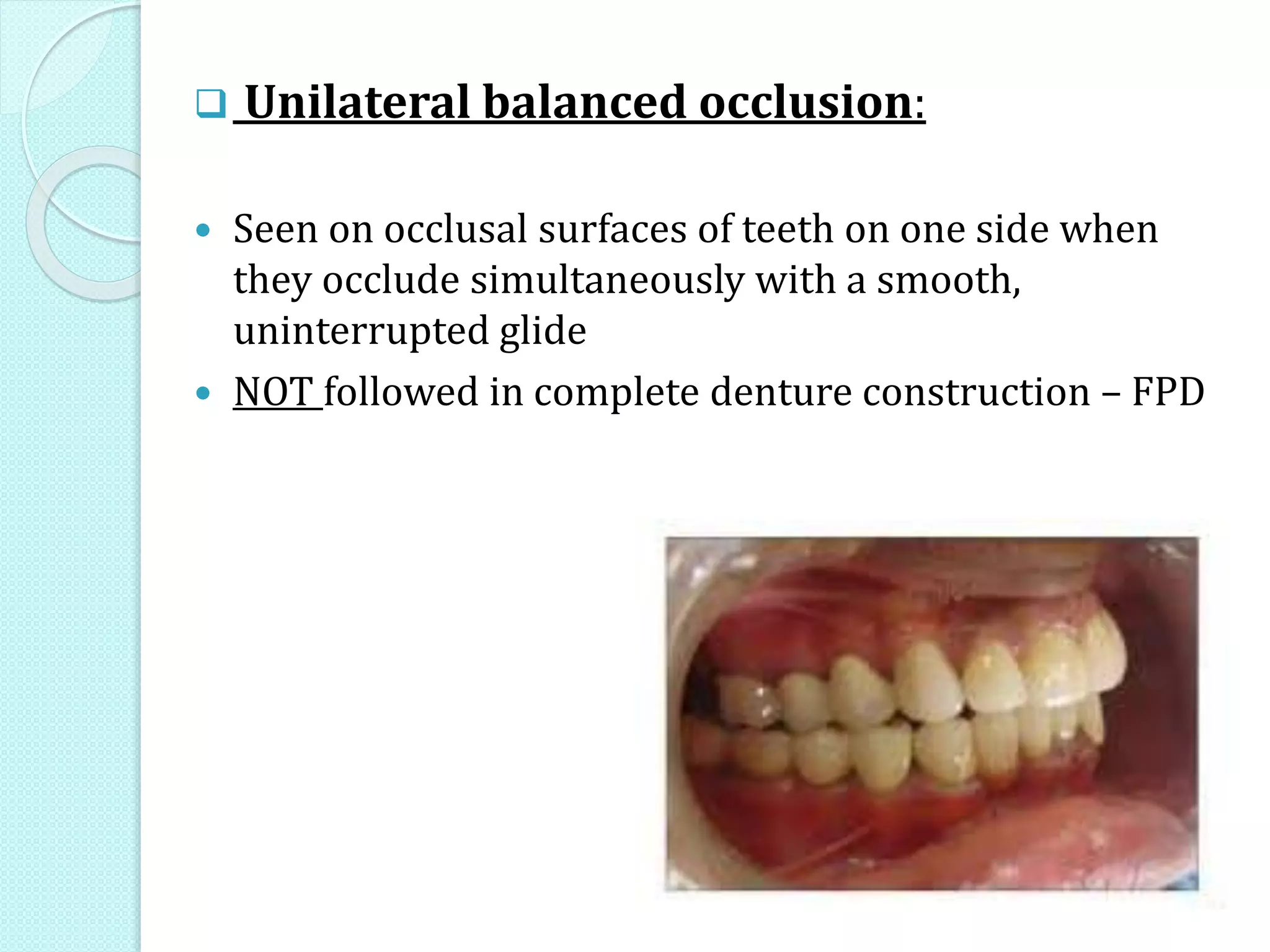 Balanced occlusion-different concepts | PPTX