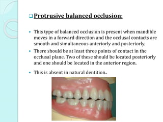 Balanced occlusion-different concepts | PPTX