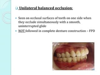 Balanced occlusion-different concepts | PPTX