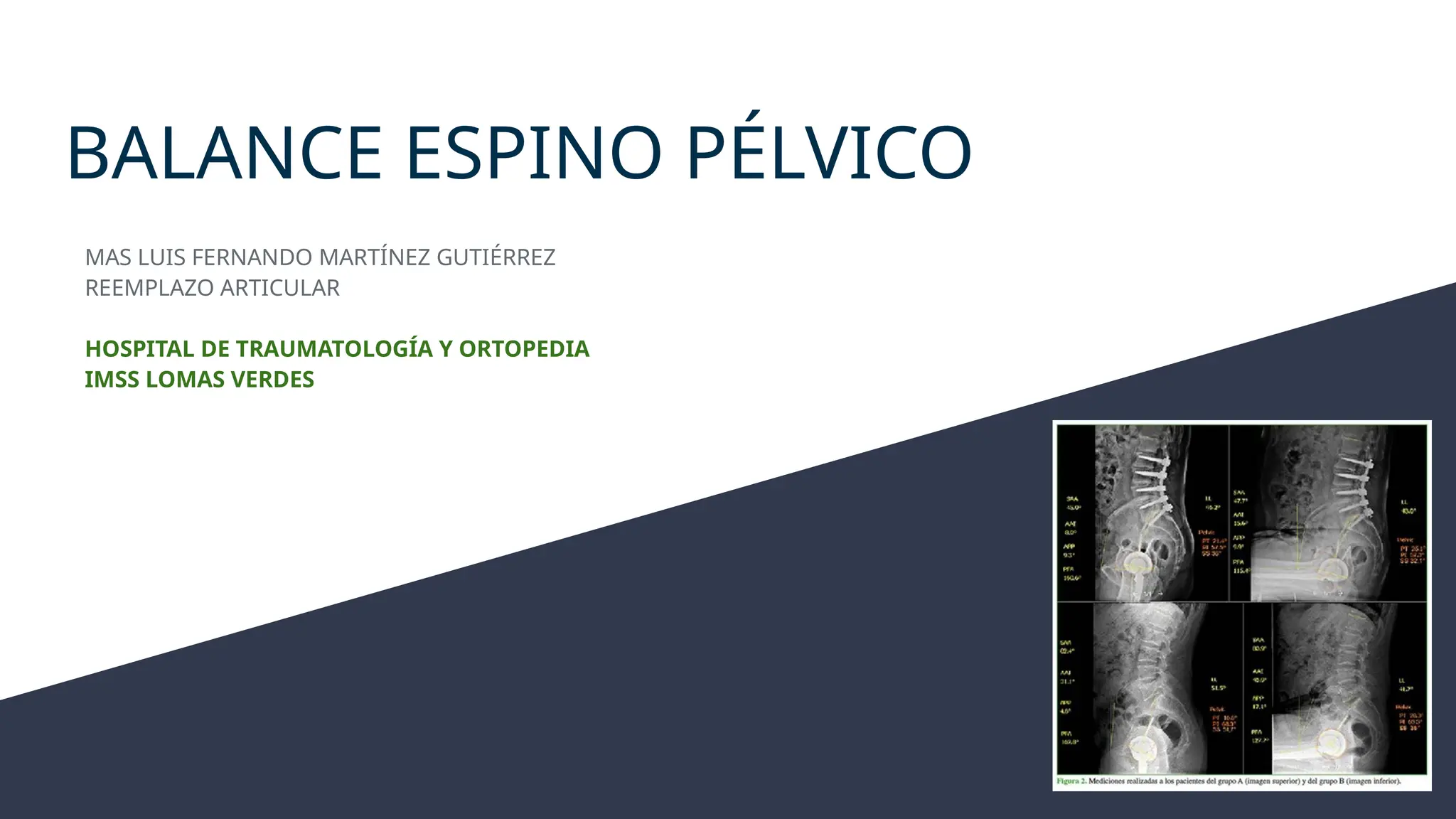 Balance Espino Pélvico ¿Qué es el Síndrome Columna Cadera? | PPTX