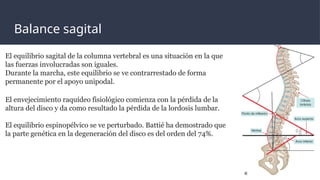 Balance Espino Pélvico ¿Qué es el Síndrome Columna Cadera? | PPTX