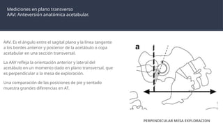 Balance Espino Pélvico ¿Qué es el Síndrome Columna Cadera? | PPTX