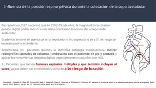 Balance Espino Pélvico ¿Qué es el Síndrome Columna Cadera? | PPTX