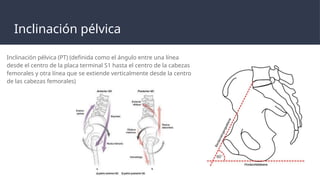 Balance Espino Pélvico ¿Qué es el Síndrome Columna Cadera? | PPTX