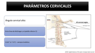 Balance sagital GAP score.pptx