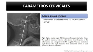 Balance sagital GAP score.pptx