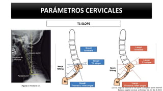 Balance sagital GAP score.pptx
