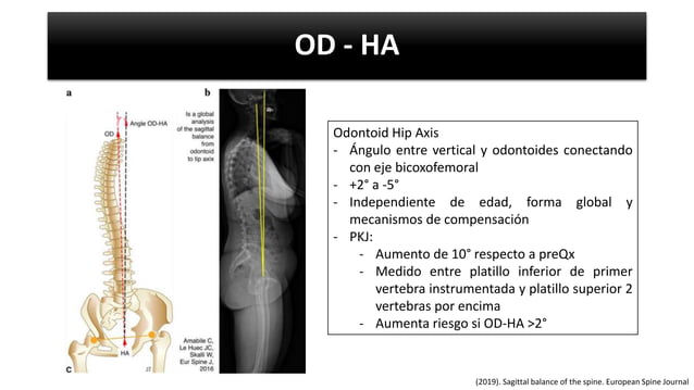 Balance sagital GAP score.pptx