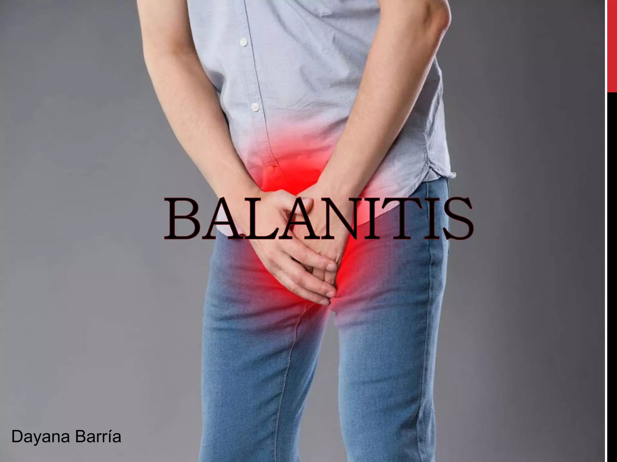 Balanitis: Causas, Síntomas Y Tratamiento – RYWXSV