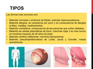 Balanitis.pptx