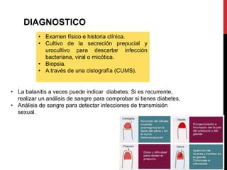 Balanitis.pptx