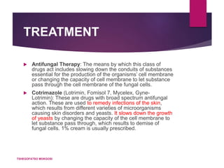 Balanoposthitis | PPTX