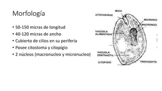 Balantidiasis | PPTX