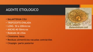 ESTUDIO DE BALANTIDIASIS EN PARASITOLOGIA | PPTX