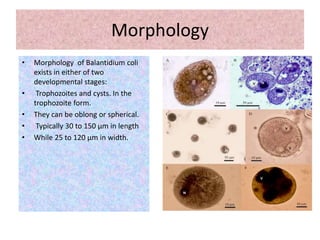 Balantidiasis ppt.pptx