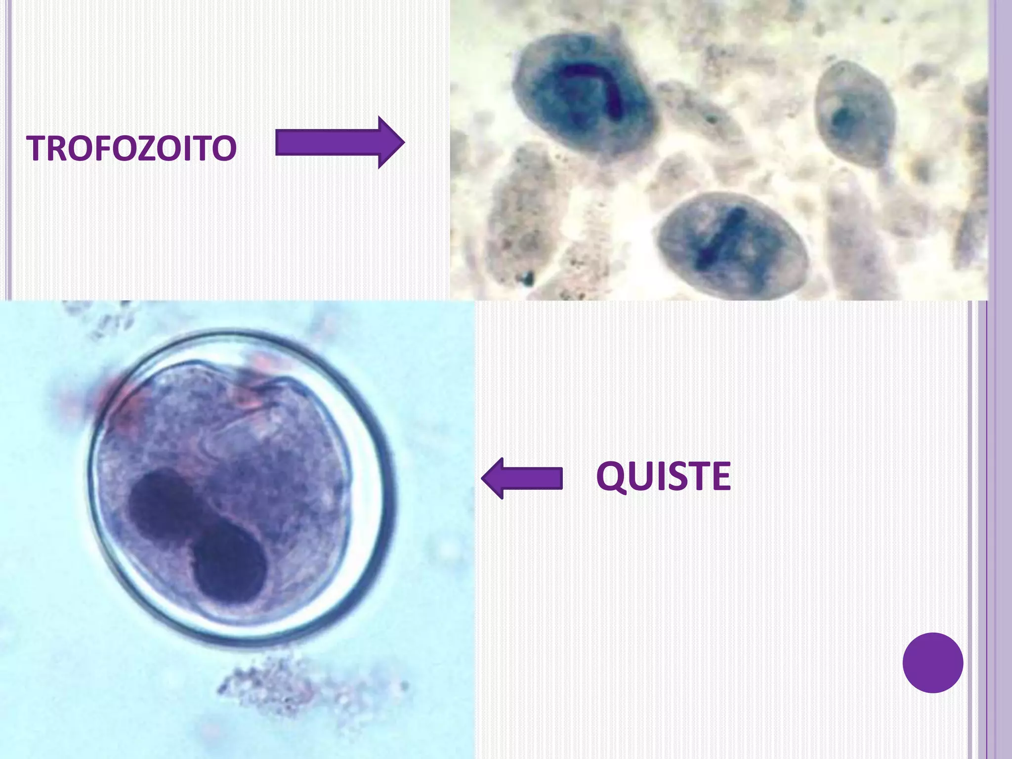 Balantidium coli