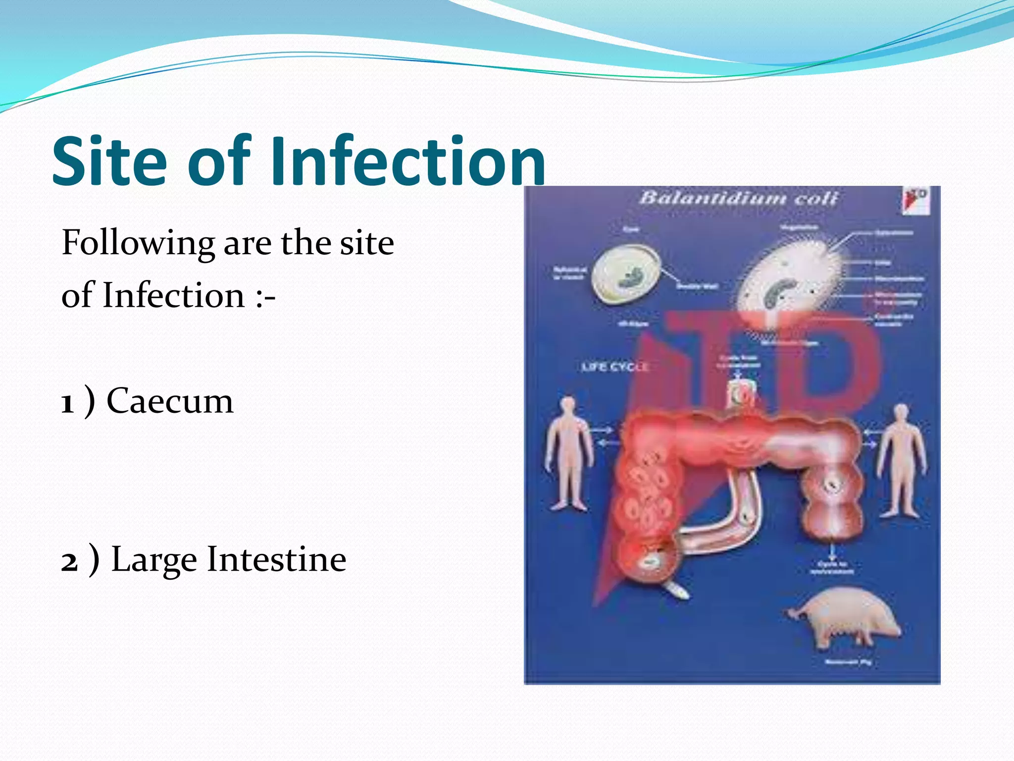 Balantidium Coli | PPTX