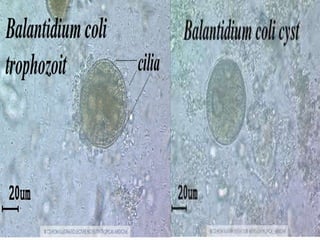 Balantidium Coli Trophozoite