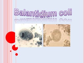 Balantidium coli | PPTX