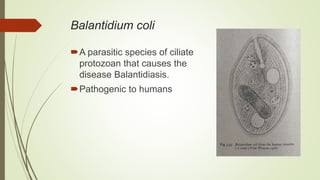 Balantidium coli | PPTX