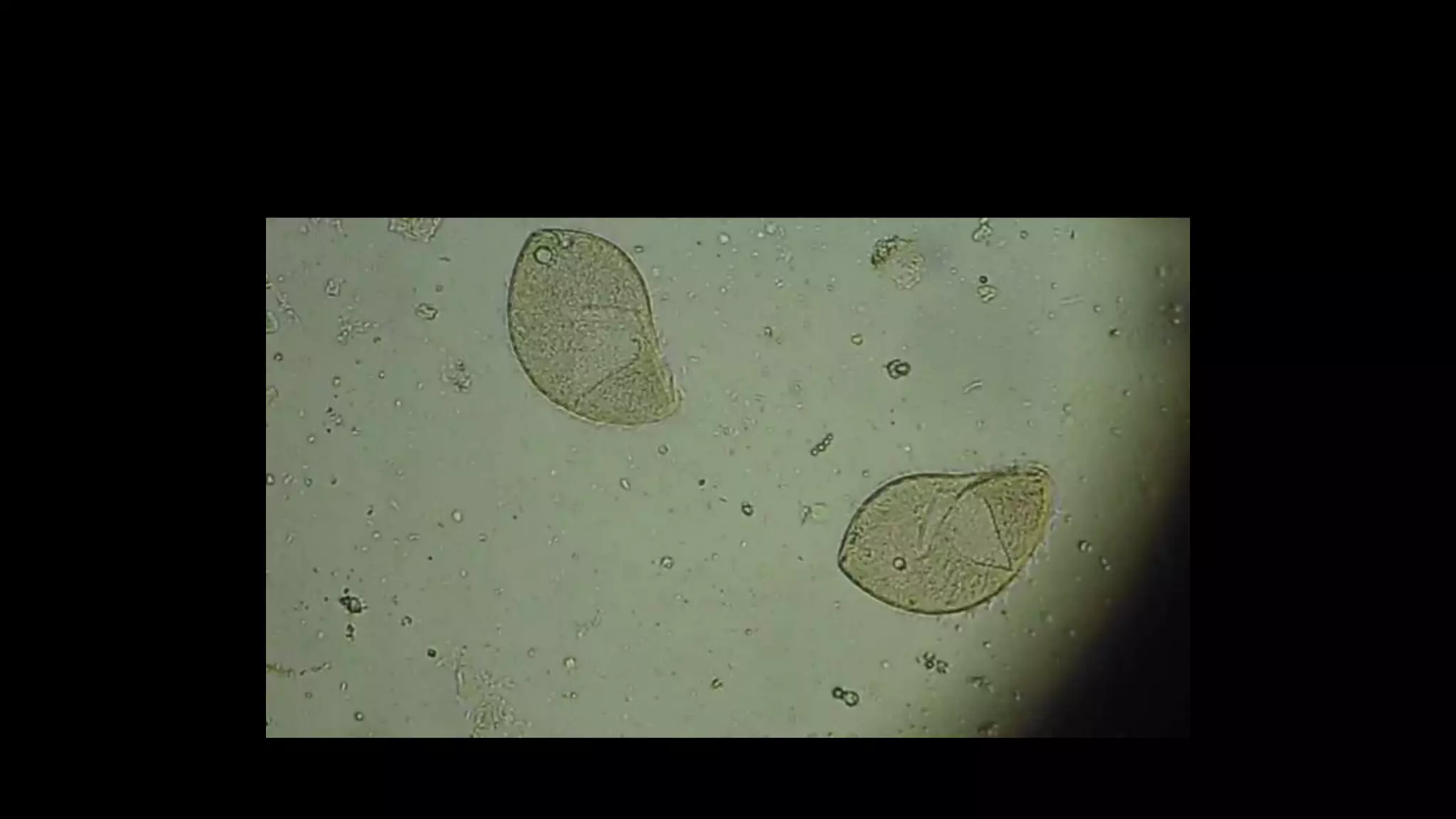 Balantidium coli | PPTX