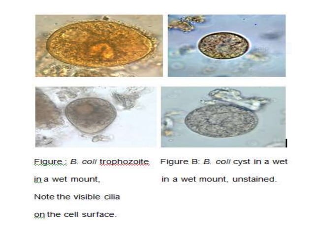 Balantidium coli | PPTX | Digestive Disorders | Diseases and Conditions