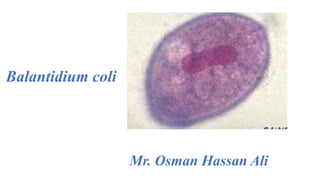 Balantidium coli.pptx medical parasitology | PPT