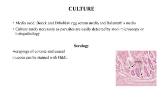 Balantidium coli.pptx medical parasitology | PPTX