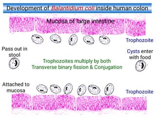 Balantidium coli parasitology medical.pdf