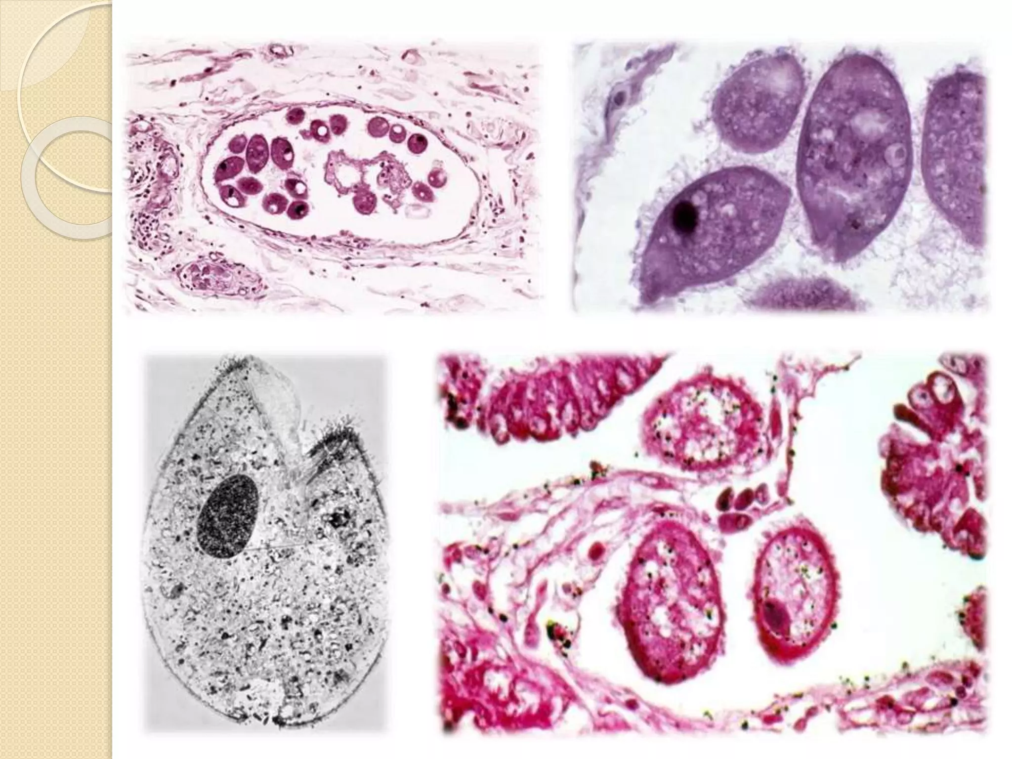 Balantidium coli | PPTX