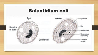 Balantidium coli and Amoeba MBChB iuiu.pptx