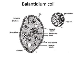 Balantidium coli medical parasitology lab | PPTX